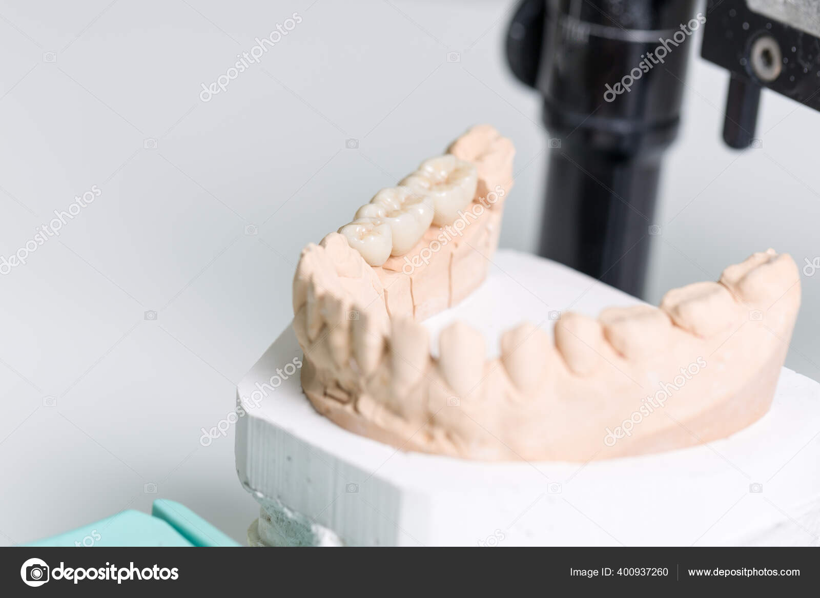 Tooth Implant Articulator Prosthesis Saddle Dent — Stock Photo ...