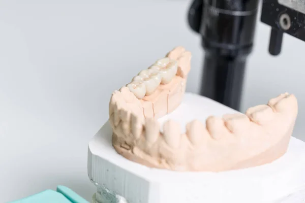 Prosthesis saddle Stock Photos, Royalty Free Prosthesis saddle Images ...