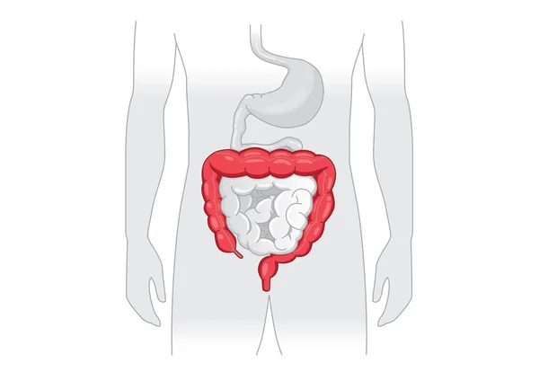 Illustration Abnormal Symptom Human Small Intestines Disease Digestive ...