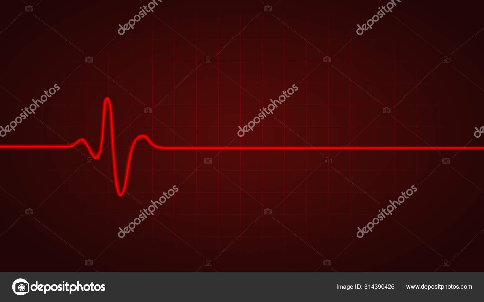 Heartbeat Monitor Dead
