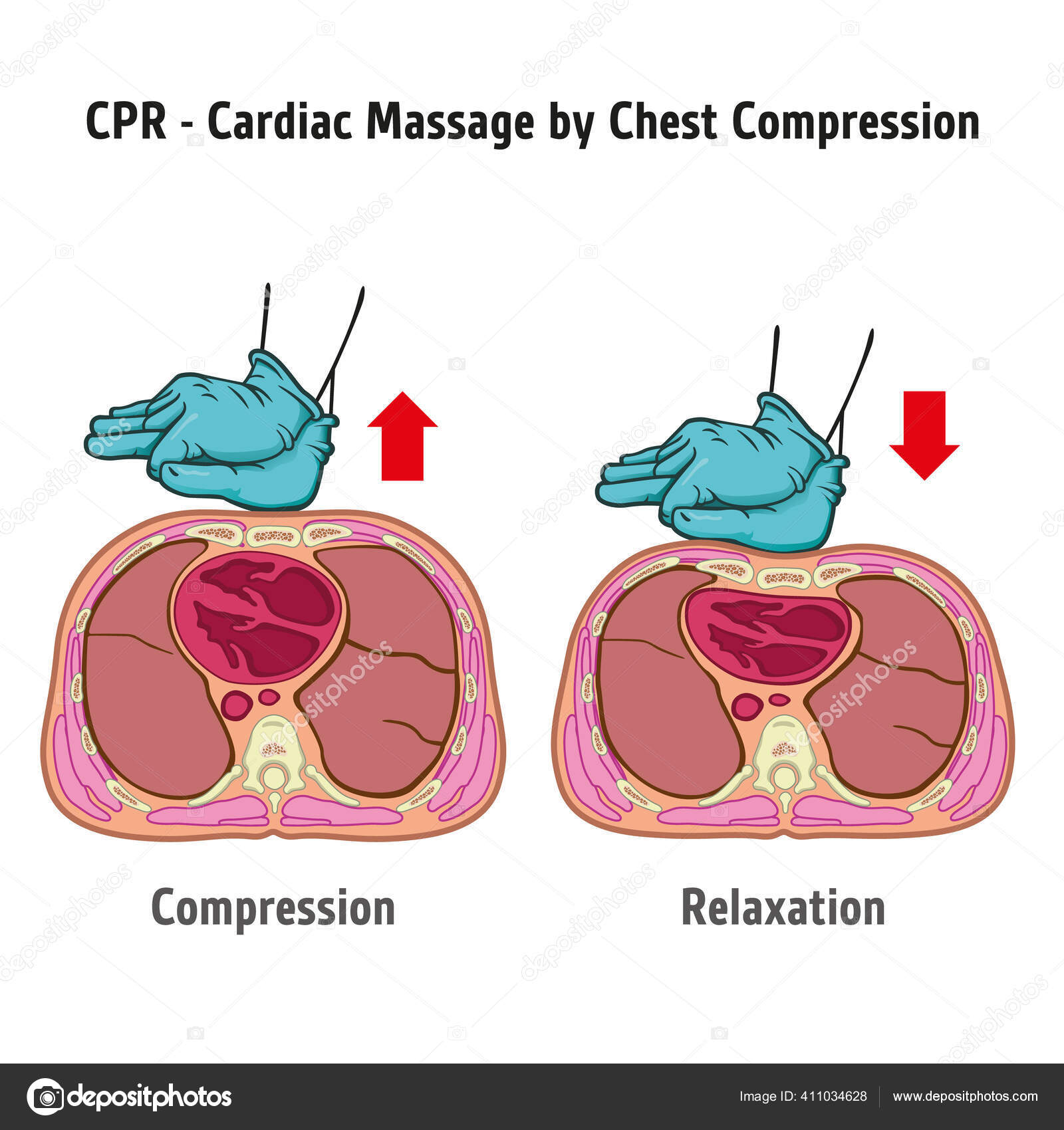 First Aid Resuscitation Cpr Chest Compression Chest Massage ...