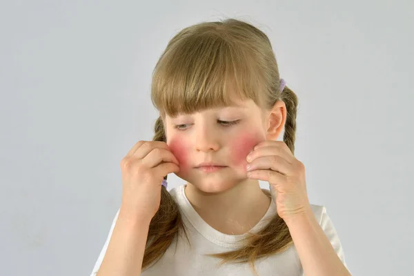 Face allergies Images - Search Images on Everypixel