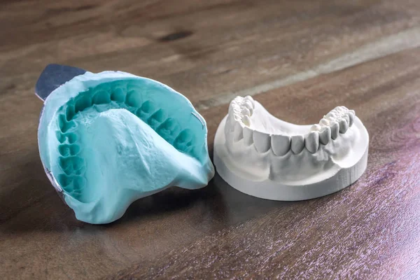 Plaster cast molds of the upper and lower jaws and teeth with a pliable ...