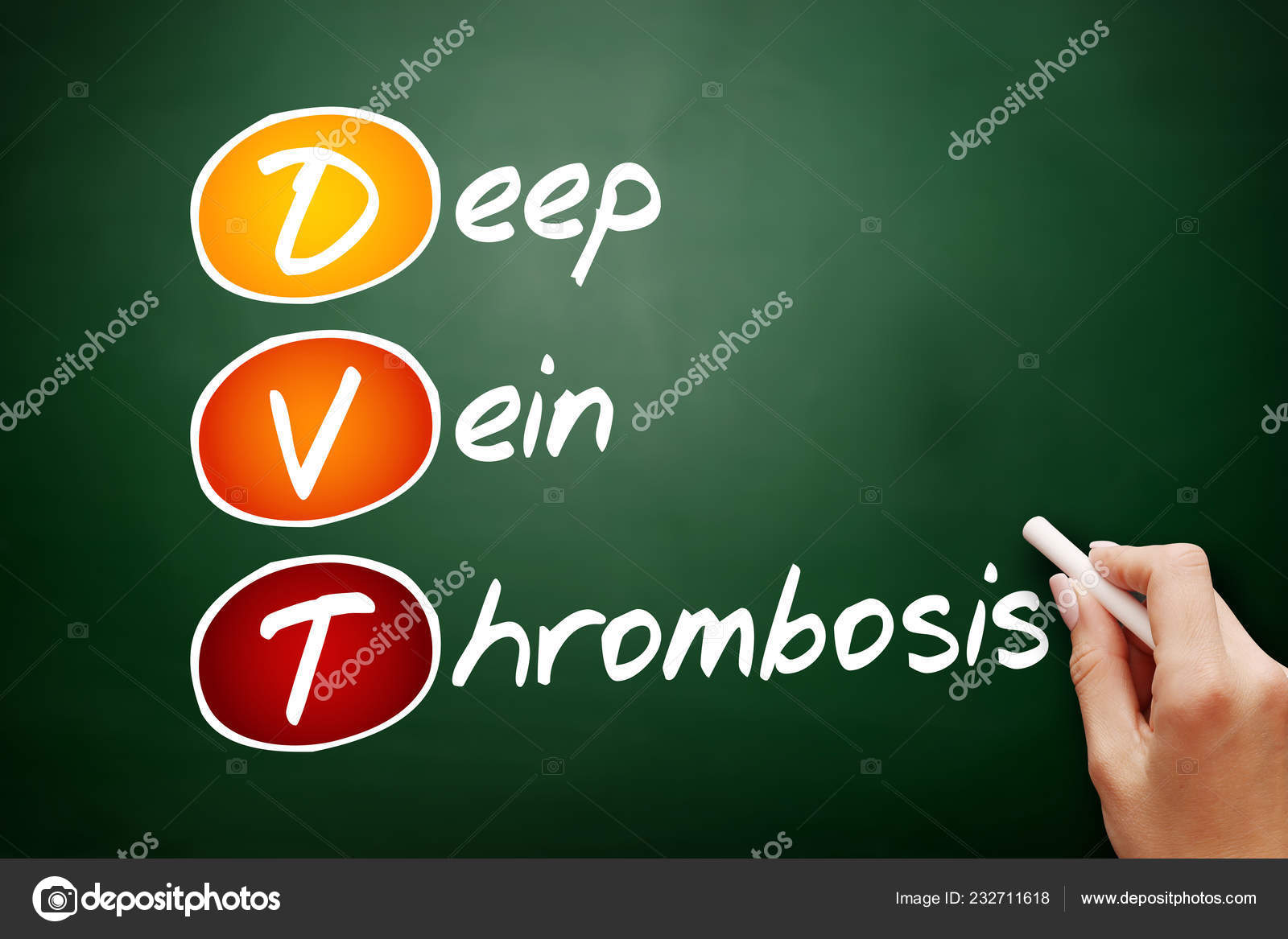 Dvt Deep Vein Thrombosis Acronym Health Concept Background Stock Photo ...