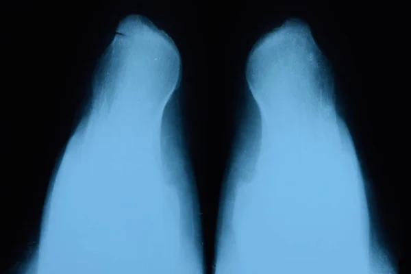 Cone beam radiography Stock Photos, Royalty Free Cone beam radiography ...