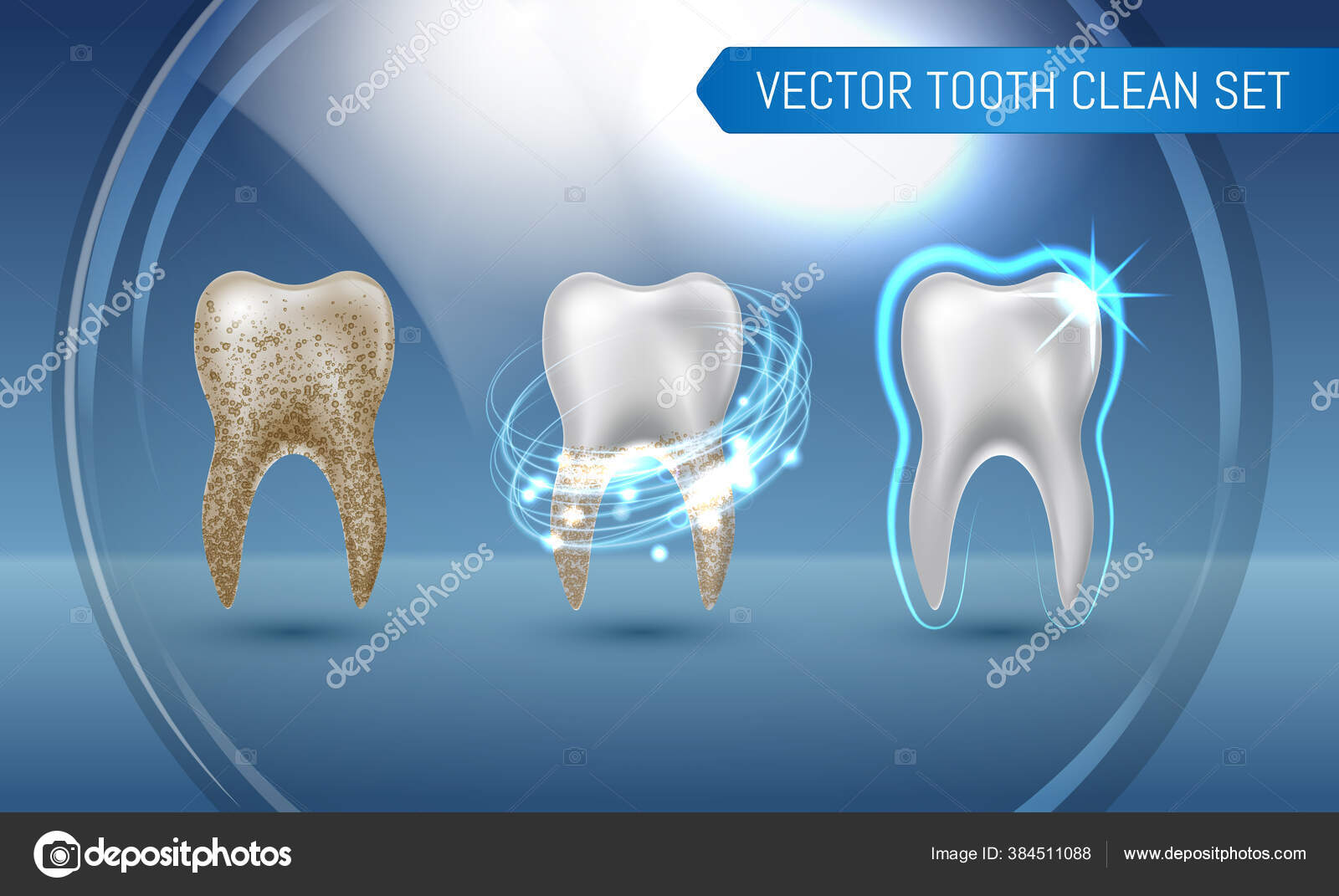 Vector set of 3d realistic clean and dirty tooth on blue background ...