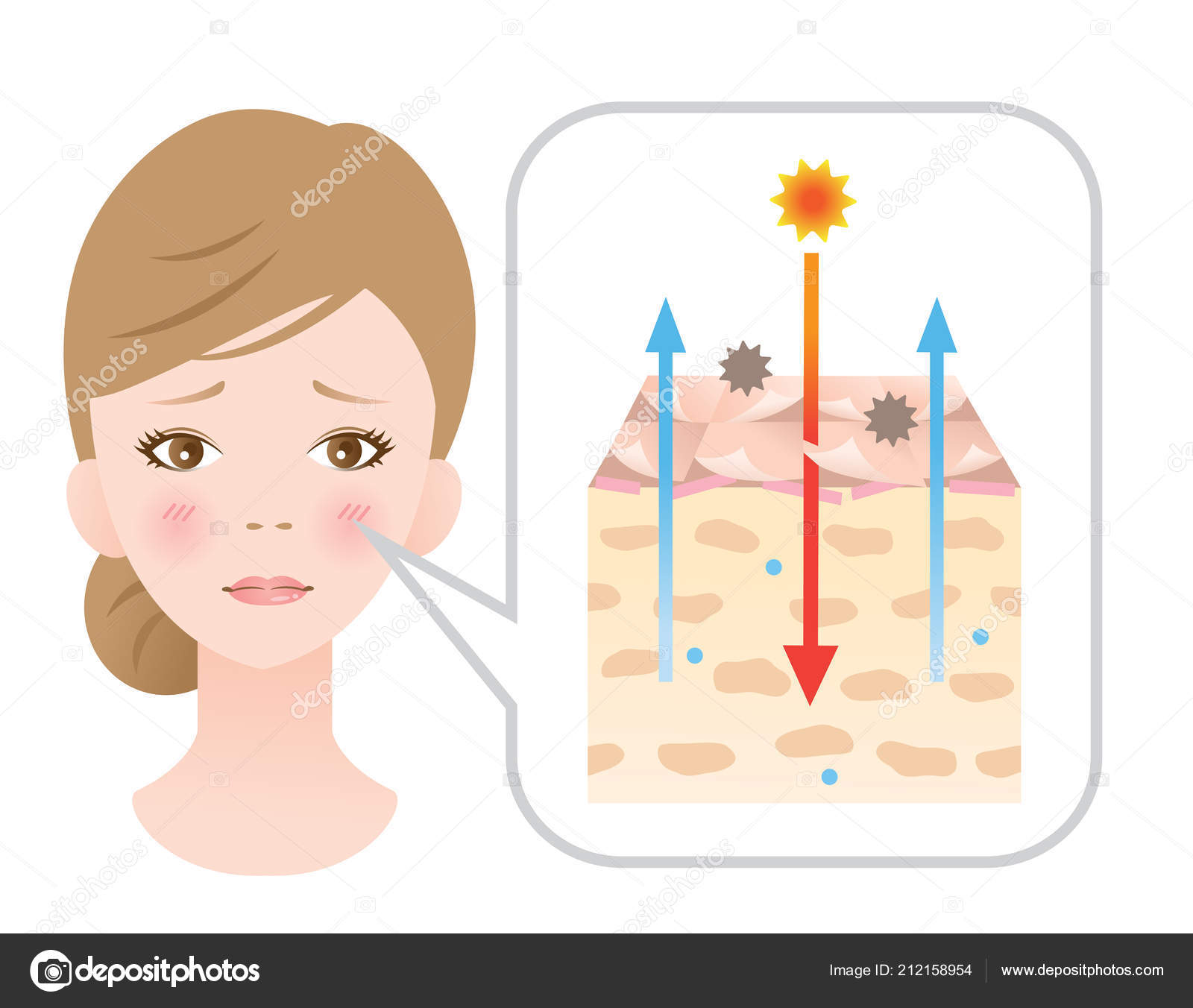 Normal Dry Skin Diagram Illustration Woman's Beauty Skin Care Concept ...