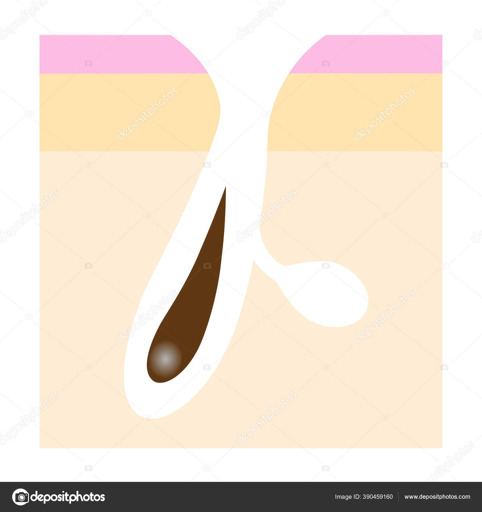 Skin Layer Enlarged Pore Illustration Facial Body Care Concept Stock ...