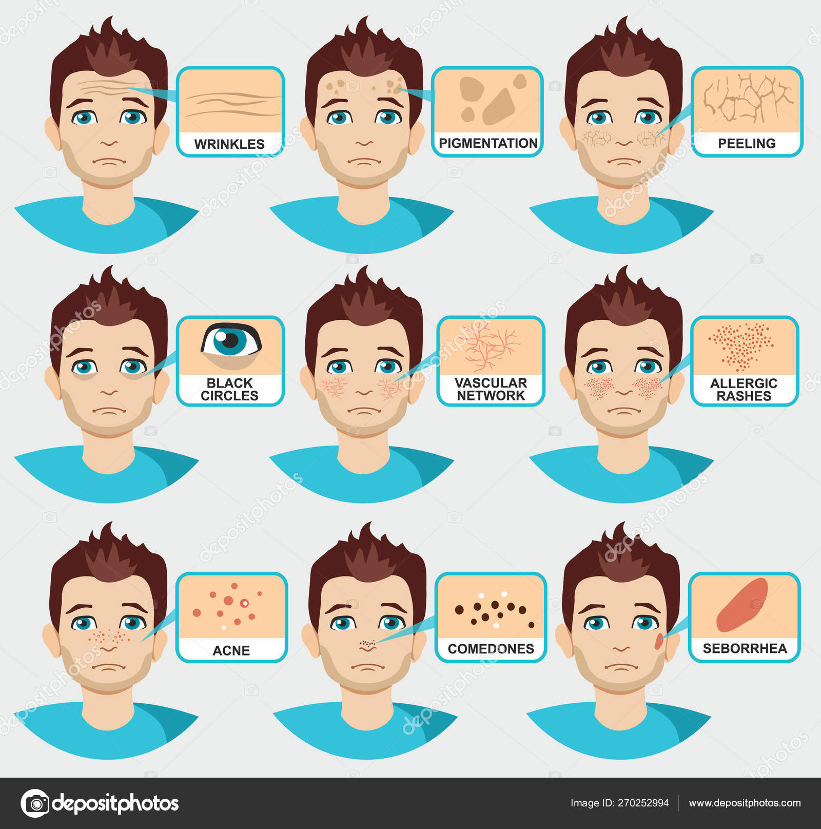 Man Skin Problems Vector Illustration Male Face Pimples Dark Spots ...