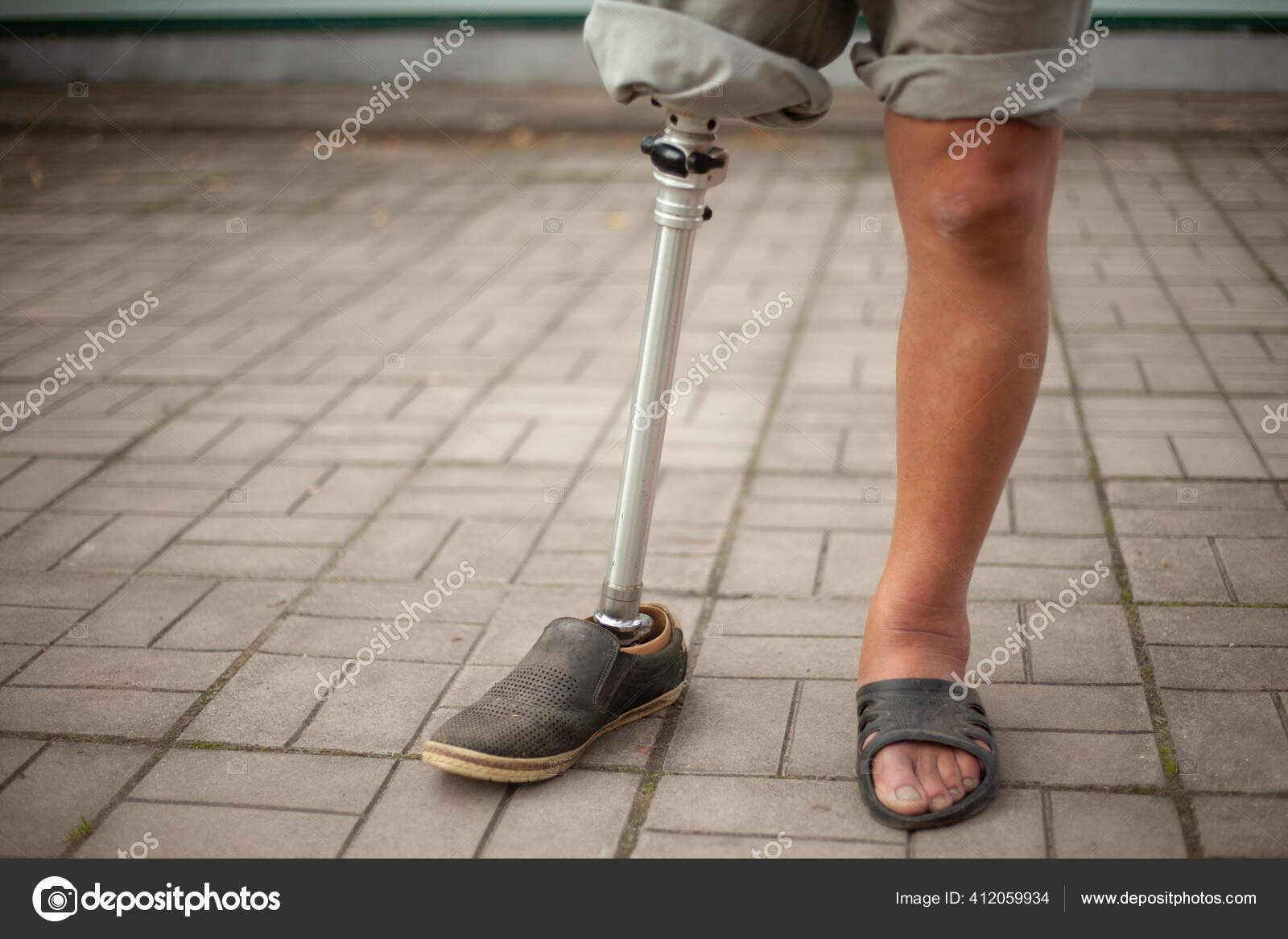 Metal prosthetic leg. Simple prosthetics for a man's leg. — Stock Photo ...