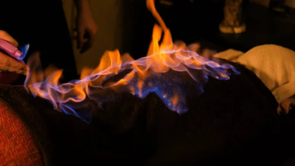 Chinese fire massage and therapy - Stock Image - Everypixel