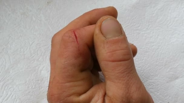 Deep cut on finger of men. Blood wound in phalanx — Stock Video ...