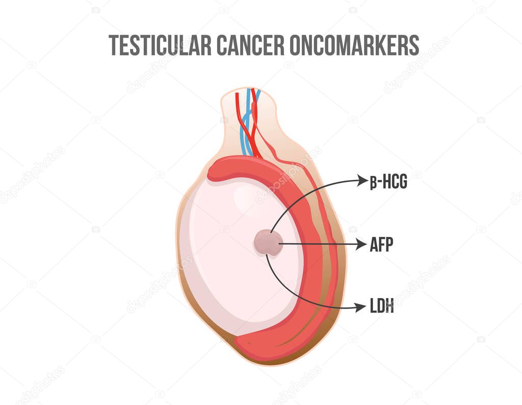 Marcadores tumorales de testículo. Cáncer testicular hormonas ...
