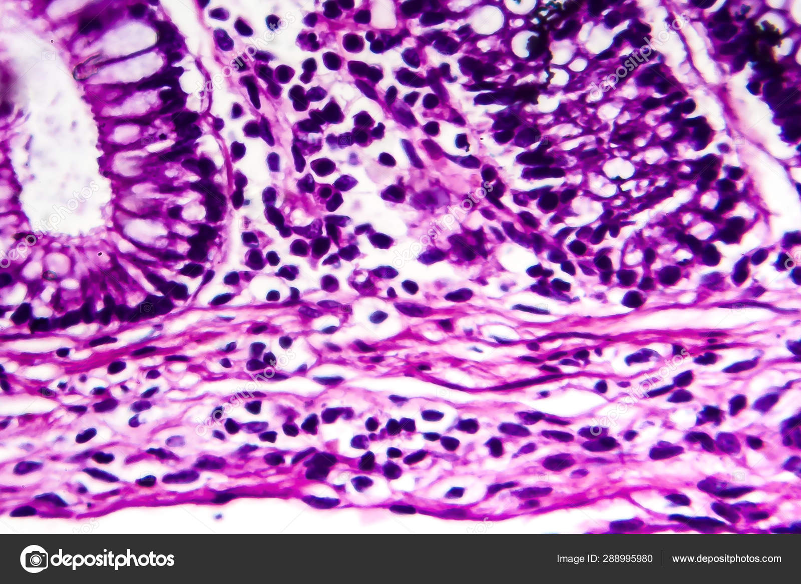 Bacillary dysentery, light micrograph — Stock Photo © katerynakon ...