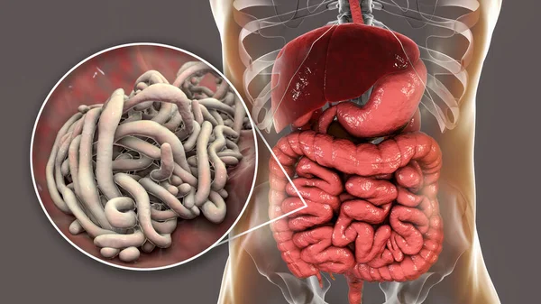 Gusanos Parásitos Intestino Delgado Humano Ilustración Ascaris ...