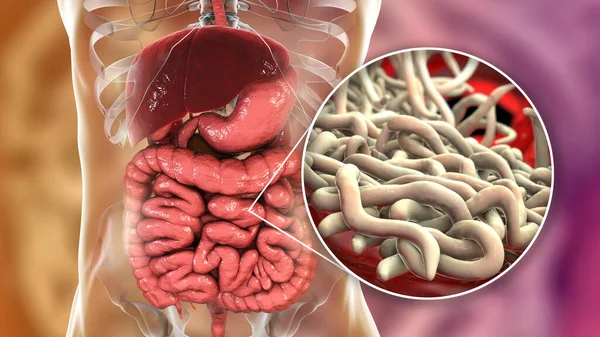Gusanos Parásitos Intestino Delgado Humano Ilustración Ascaris ...