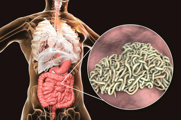 Gusanos Parásitos Intestino Delgado Humano Ilustración Ascaris ...