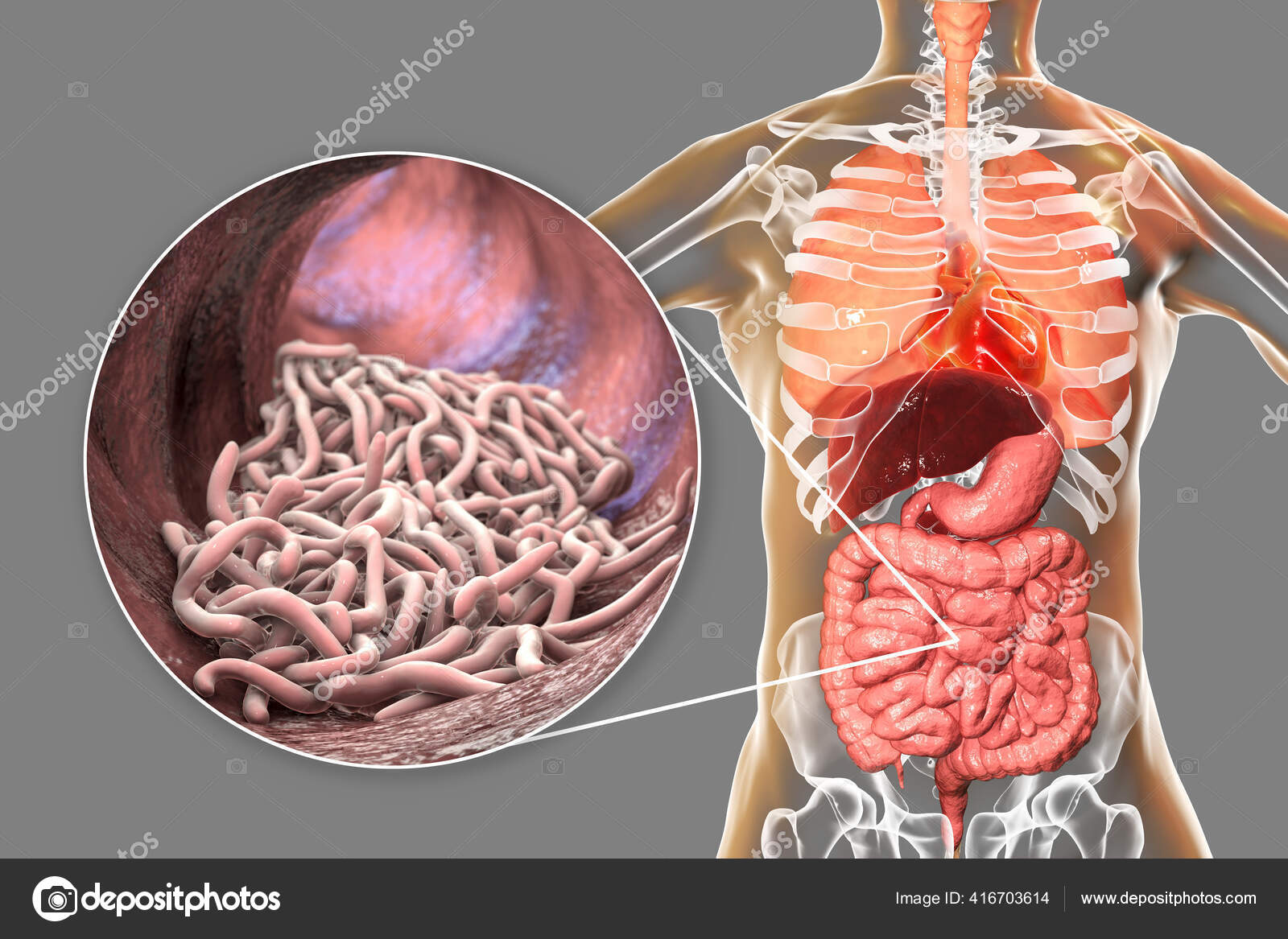 Pinworm In Human Stool