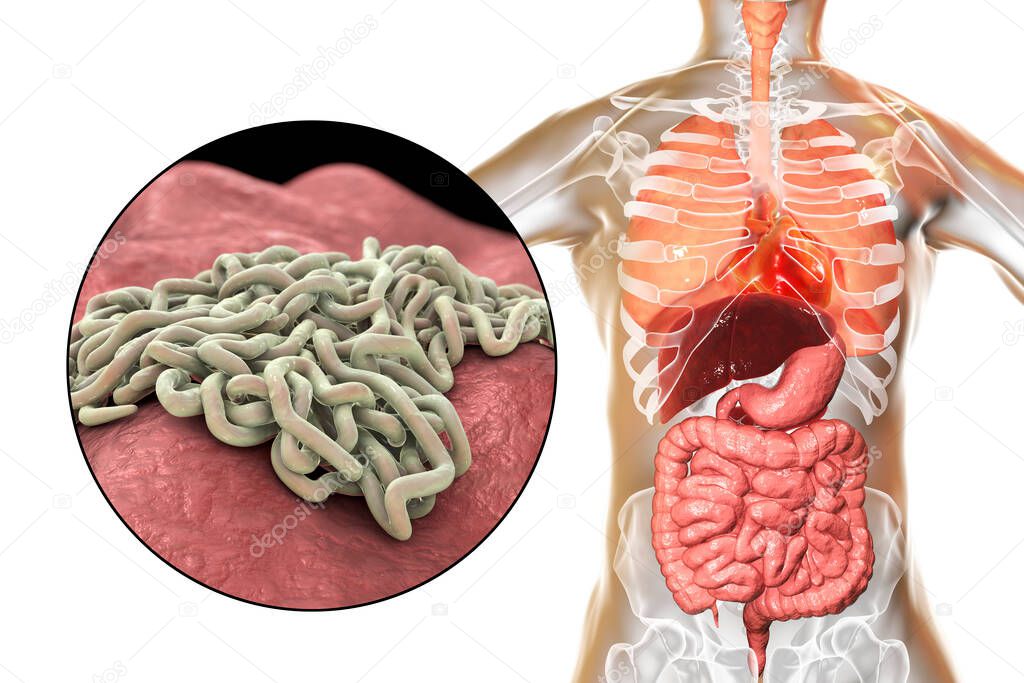Gusanos parásitos en el intestino humano, ilustración 3D. Ascaris ...