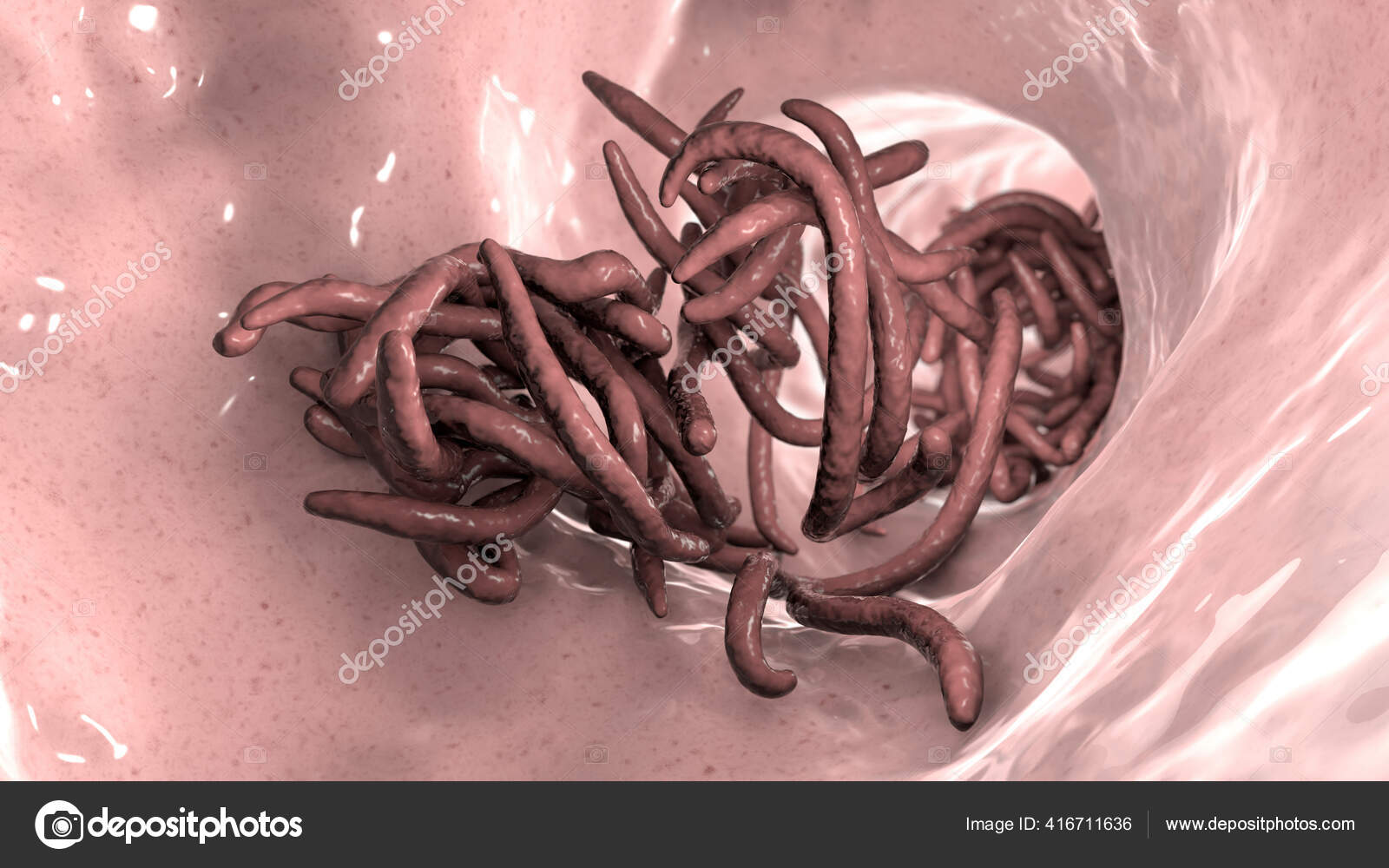 Ascaris Worms Artwork Of Nematode Worms Ascaris Sp. In Intestine