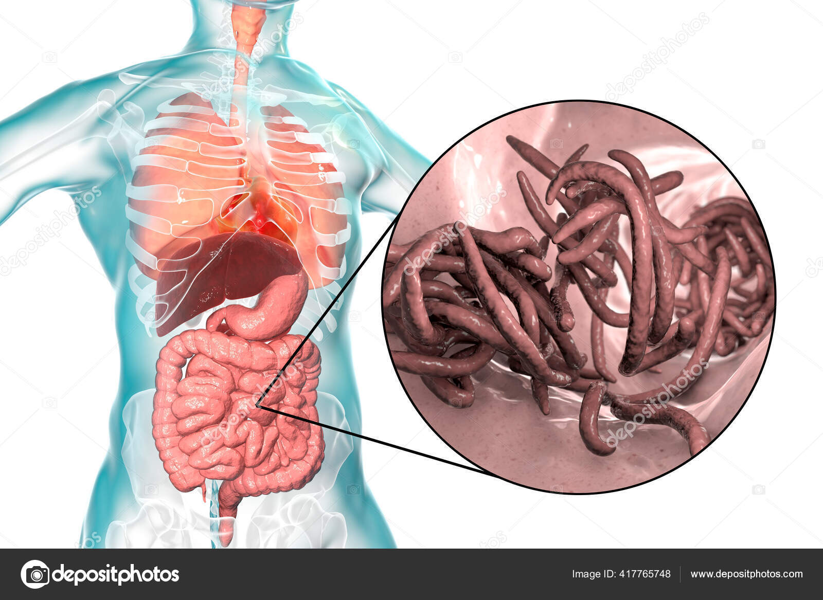 Ascaris Lumbricoides Anatomy External Parasitic Worms Human Intestine