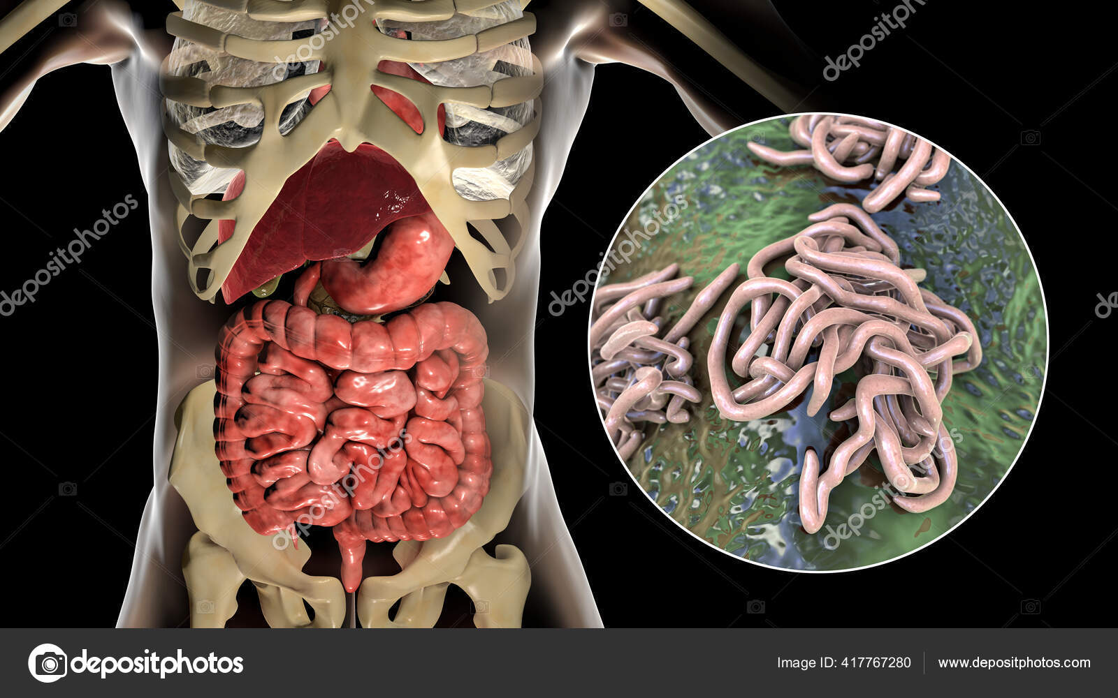 Parasitic Worms Human Small Intestine Illustration Ascaris Lumbricoides ...