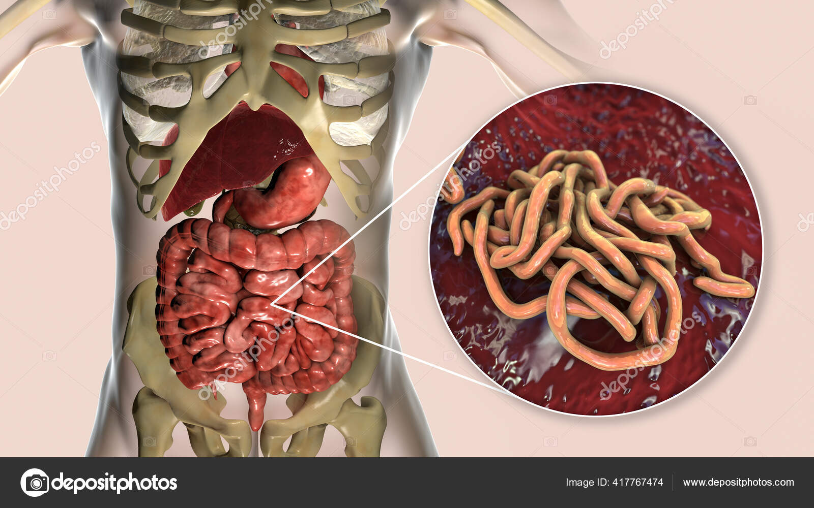 Vermes Parasitas Intestino Delgado Humano Ilustração Ascaris ...