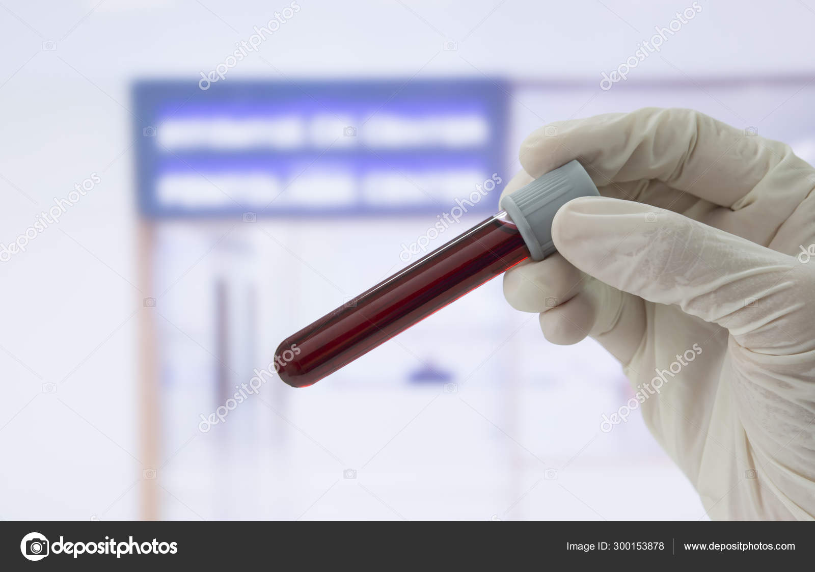 Blood sample — Stock Photo © utah778 #300153878