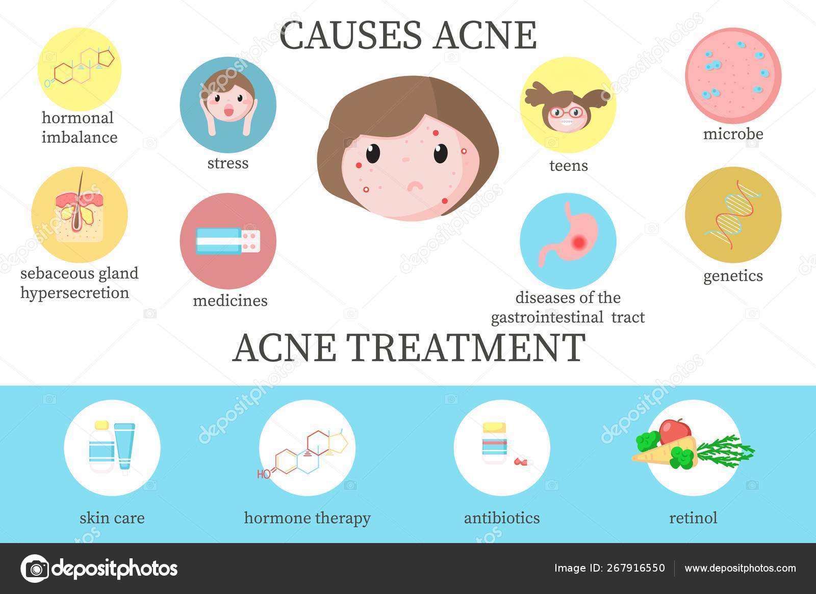 Acne causes and treatment diagram, vector flat illustration Stock ...