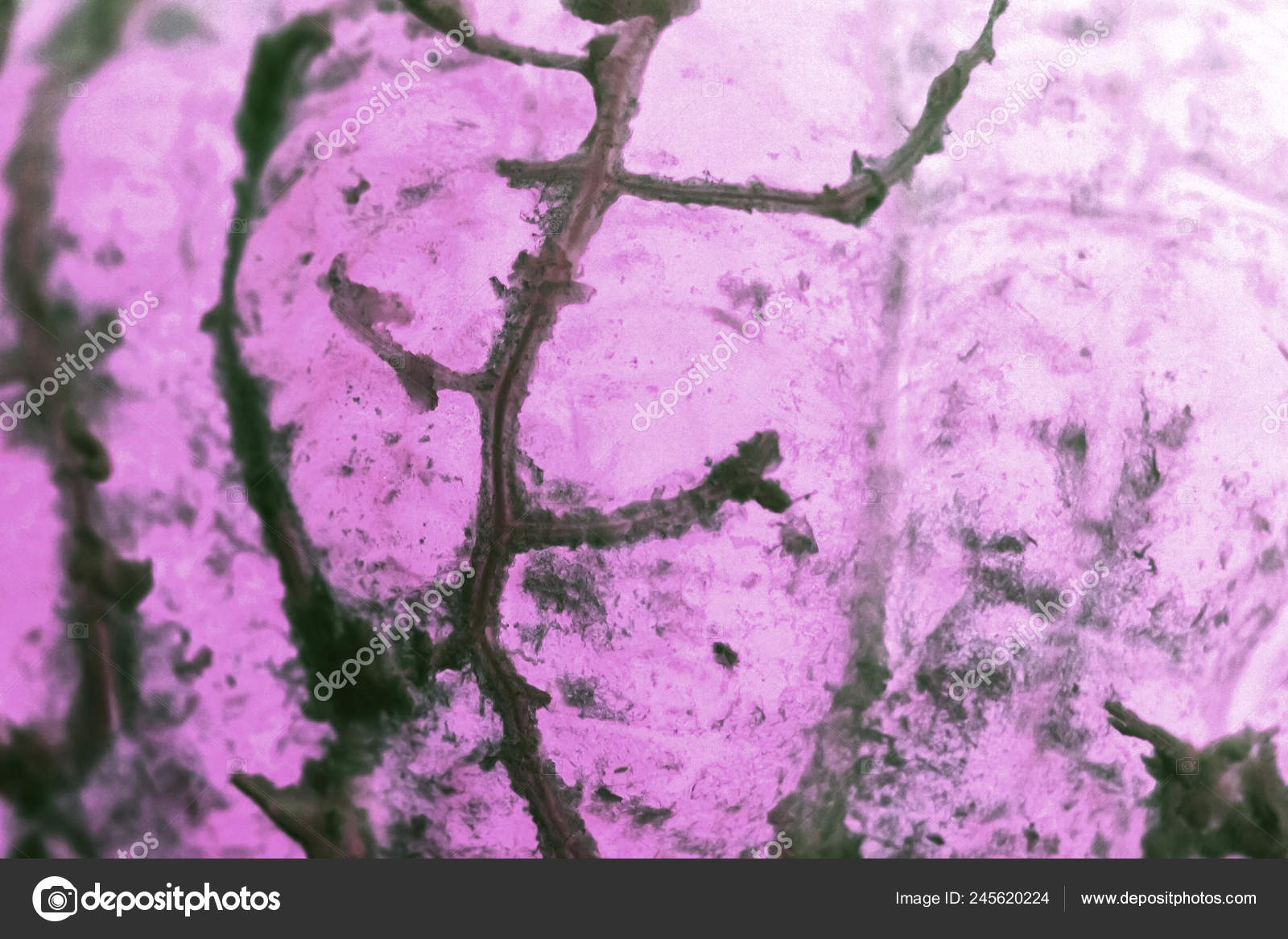 Human Squamous Cell Carcinoma Tissues Affected Cancer Cells Microscope ...