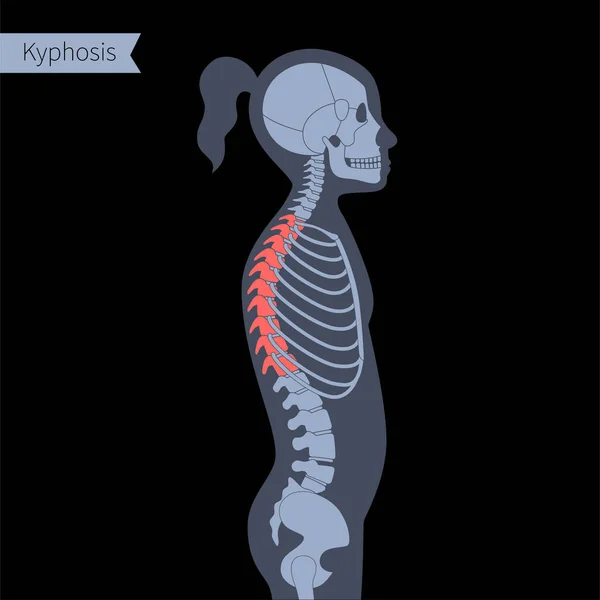 Rib Cage Ribs Spine Hip Bone Skeleton Anatomy Human Skeletal Stock ...