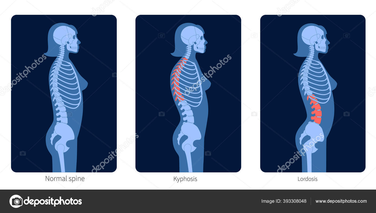 Spine X ray Stock Vector by ©Pikovit 393308048