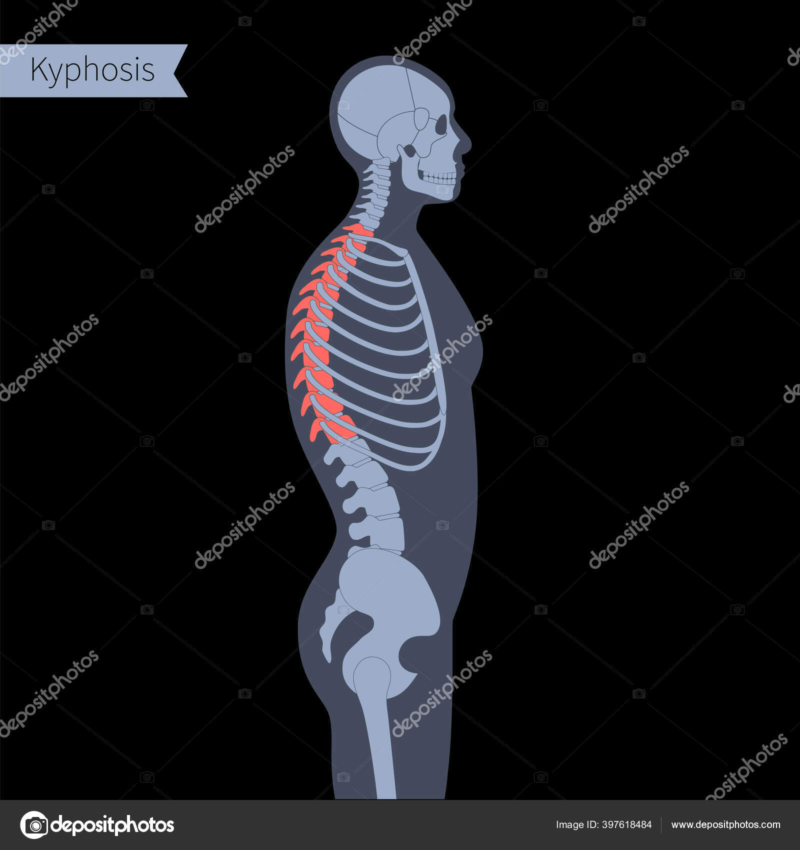 Spine X ray Stock Vector Image by ©Pikovit #397618484