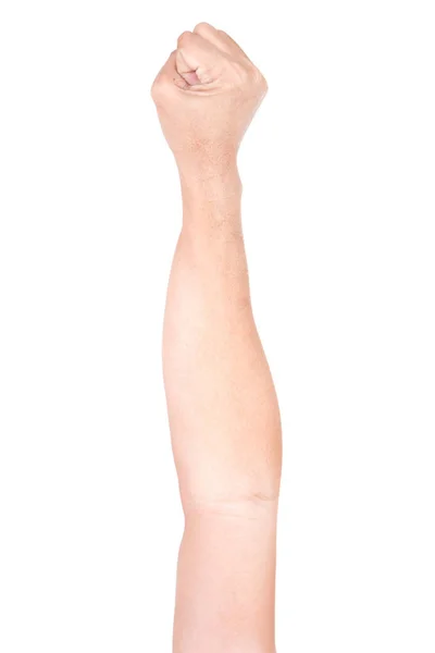 Swollen arm Stock Photos, Royalty Free Swollen arm Images | Depositphotos