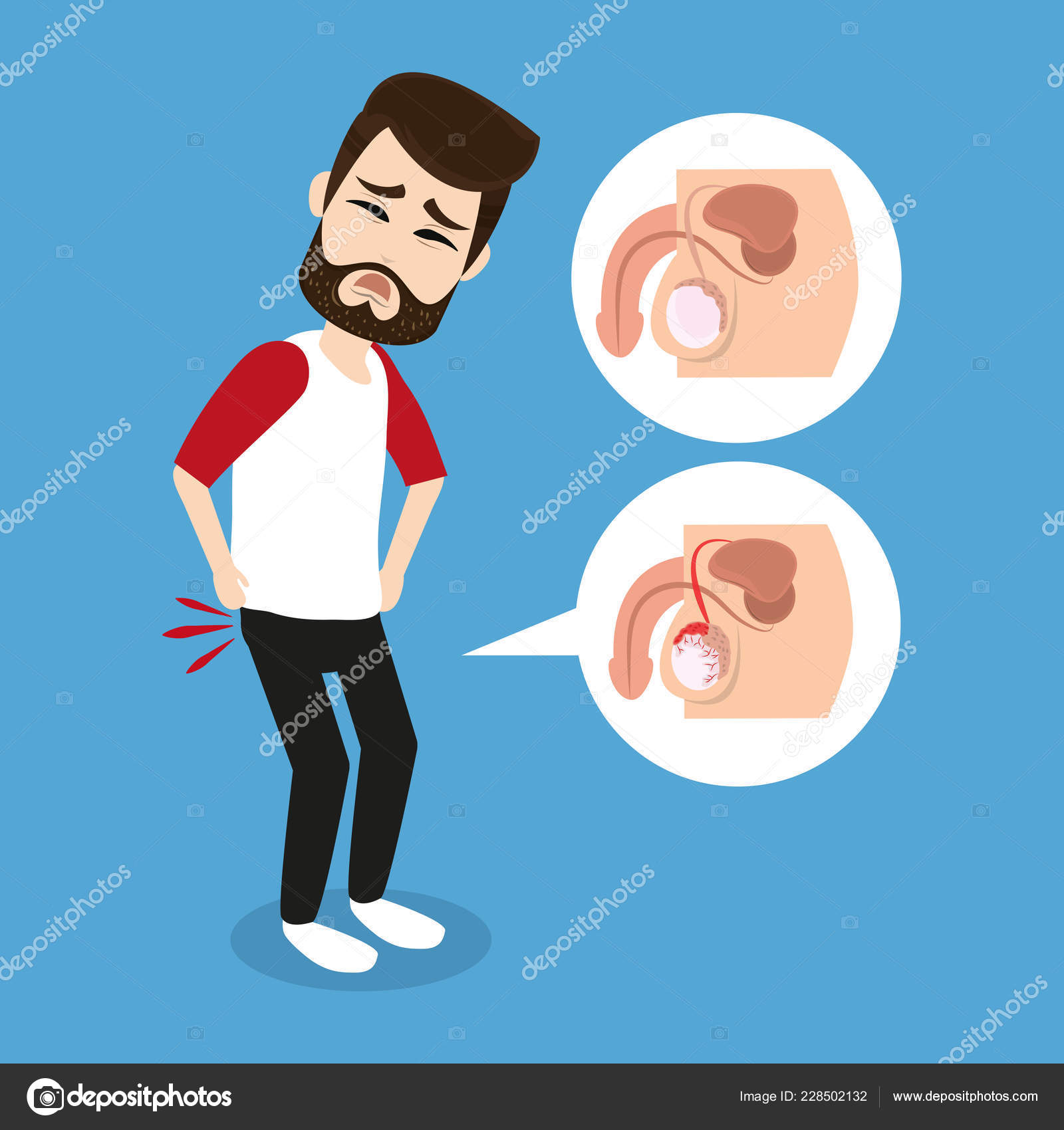 Prostate cancer campaign Stock Vector by ©jemastock 228502132