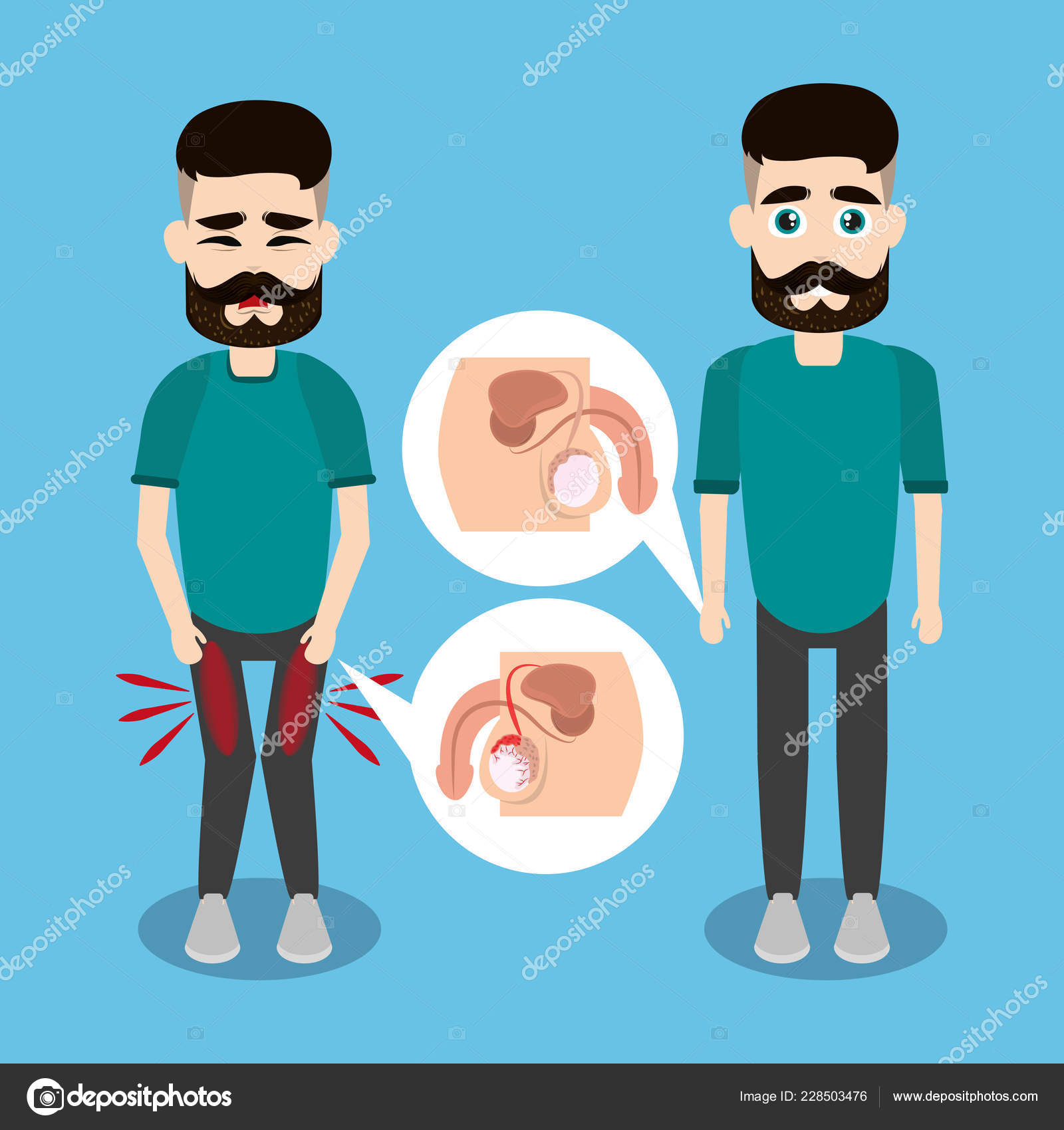 Campaña contra el cáncer de próstata vector, gráfico vectorial ...
