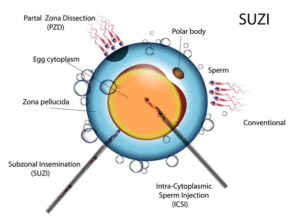 Pictures : plants and animals cells | Plant cell structure — Stock ...