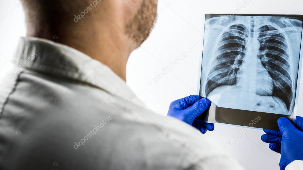 Radiografía de tórax, médico y radiografía de pulmón, primer plano.Un ...