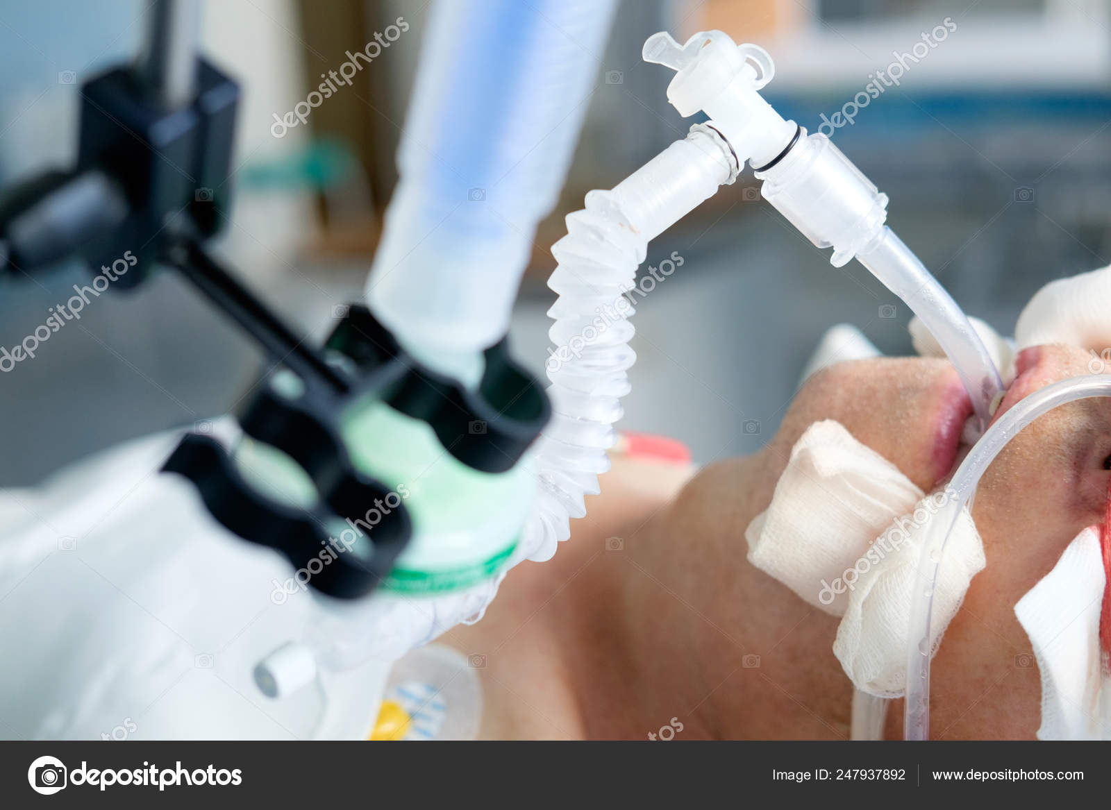 Paciente en estado crítico. Hombre blanco adulto intubado bajo AVL l ...