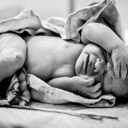 Afterbirth Stock Photos, Royalty Free Afterbirth Images | Depositphotos