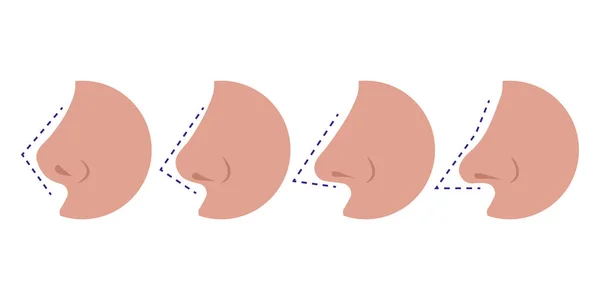 ᐈ Different types of cartoon noses stock vectors, Royalty Free ...