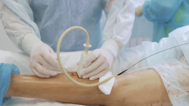 1,634 Metoda leczenia Videos, Royalty-free Stock Metoda leczenia ...