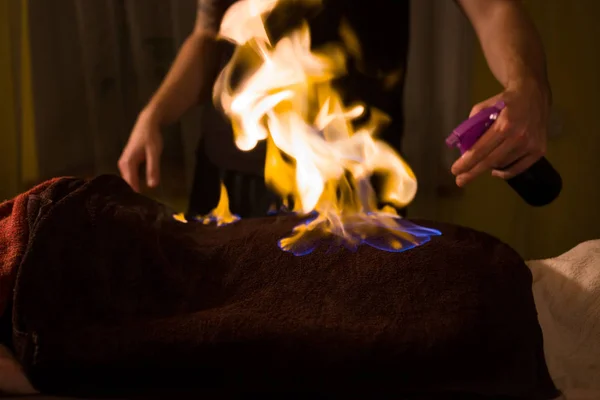 Chinese fire massage and therapy - Stock Image - Everypixel