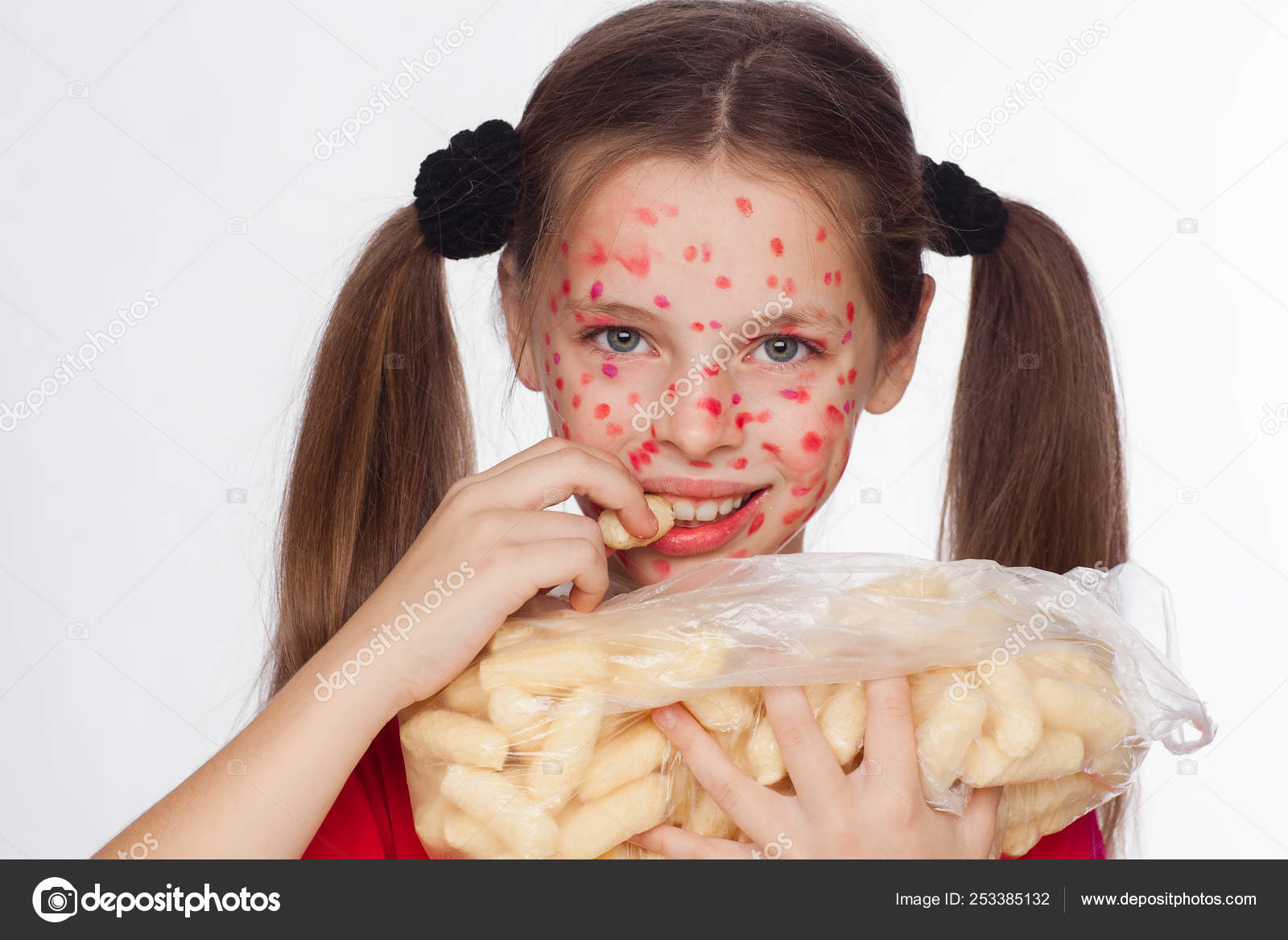 Front view of a girl with a problem skin rash who eats corn sticks ...