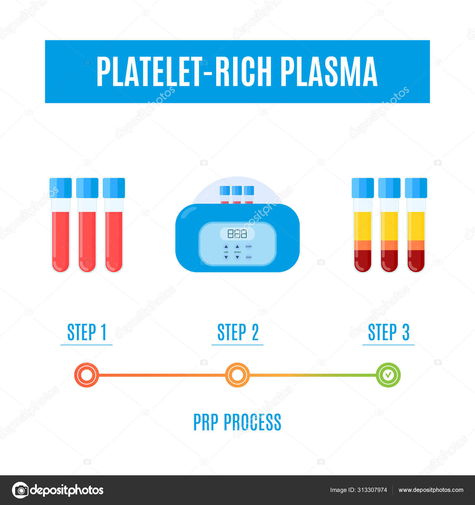 Medical infographics for platelet rich plasma procedure Stock Vector ...