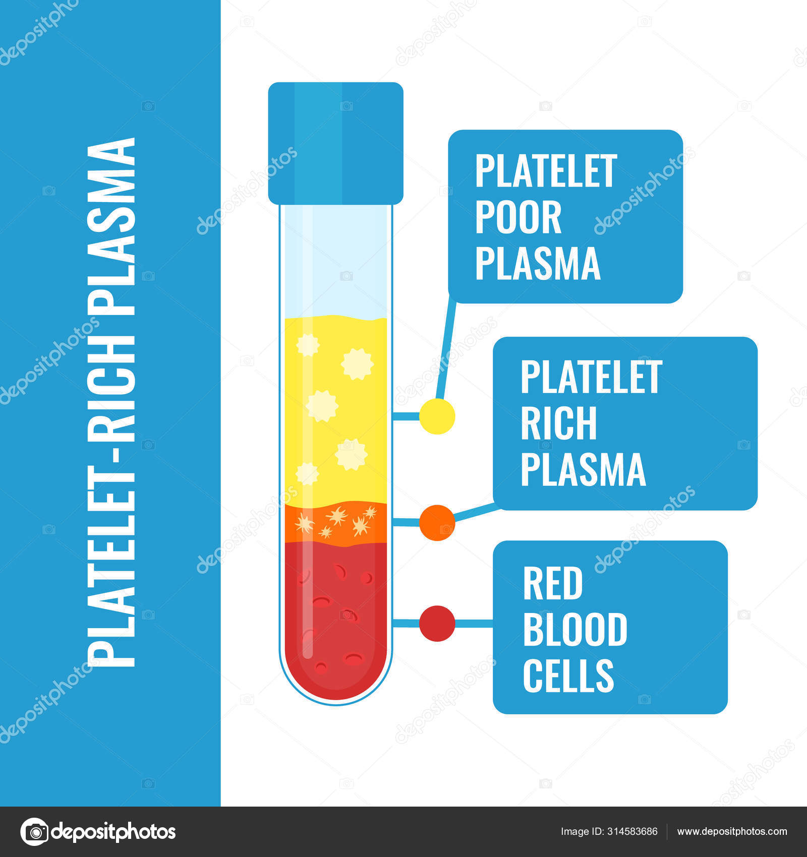 Platelet rich plasma composition medical infographics poster Stock ...