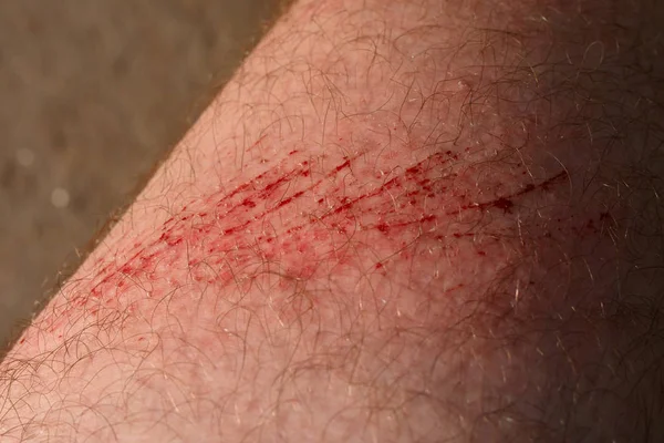 Bloody Cracked Skin Texture