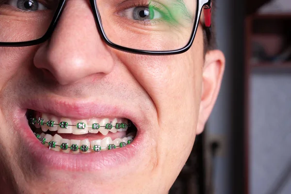 Portrait of a man with crooked teeth and metal braces with green rubber ...