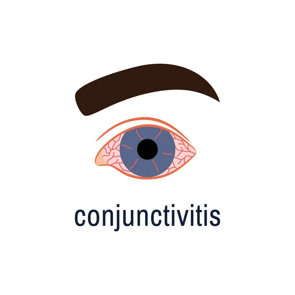 Conjunctiva Vector Art Stock Images | Depositphotos