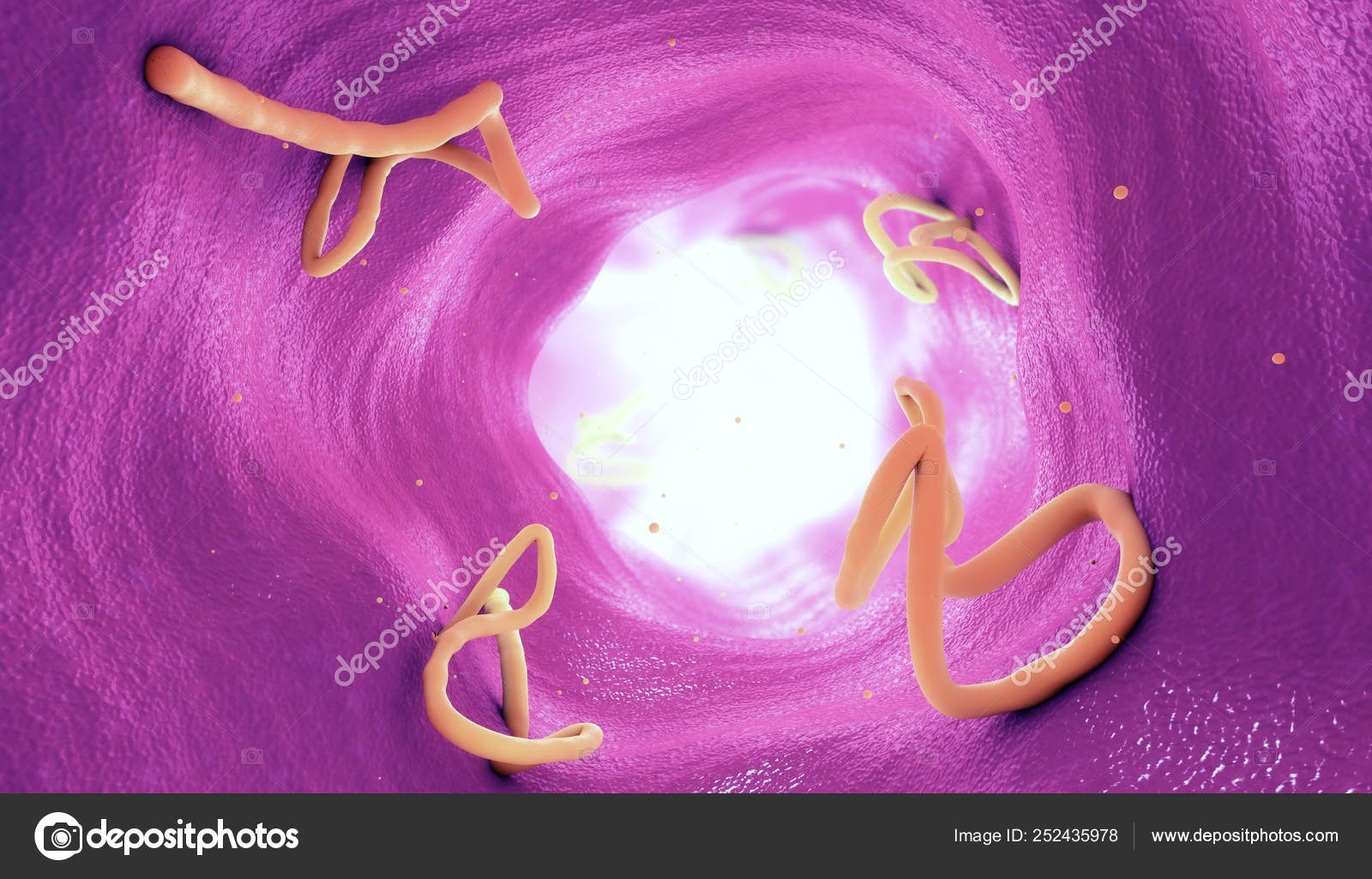 Tapeworm infestation in a human intestine - 3d illustration Stock Photo ...